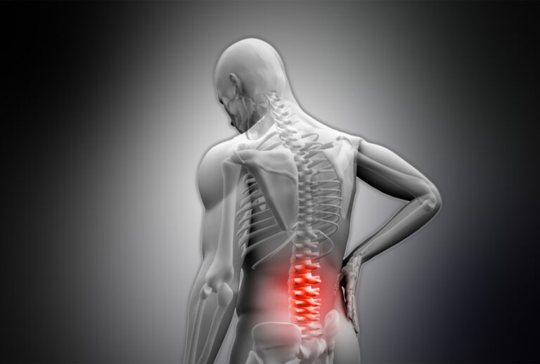 What Are Common Back Injuries?